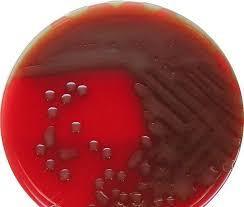 Meningitis | Mind Map