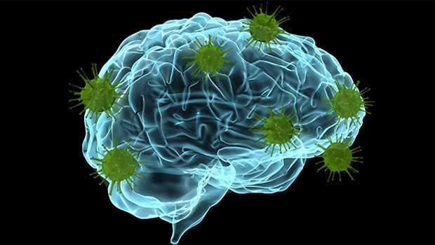 Meningitis | Mind Map