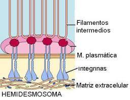 Red Microtrabecular | Mind Map