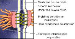 Red Microtrabecular | Mind Map