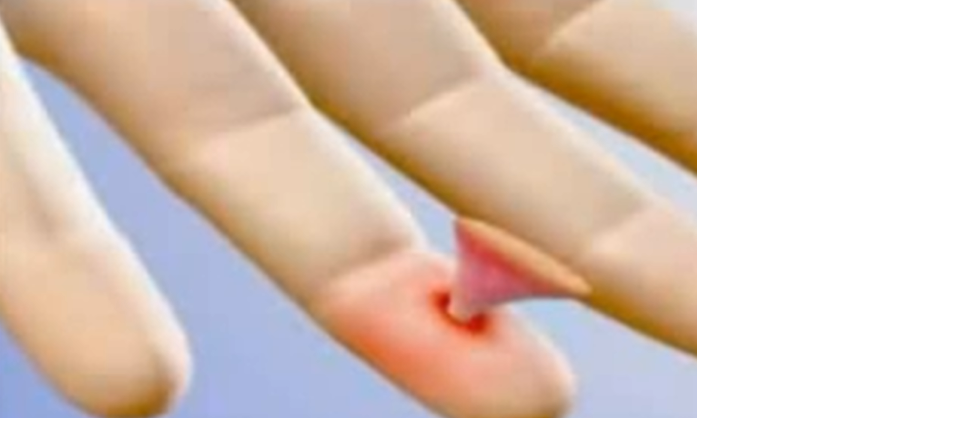 INFLAMACIÓN | Mind Map