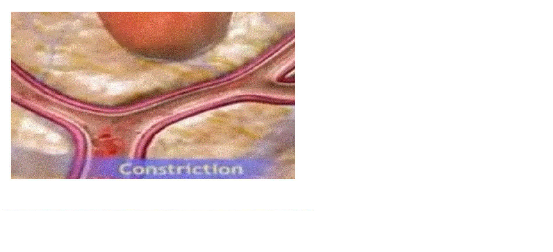 INFLAMACIÓN | Mind Map