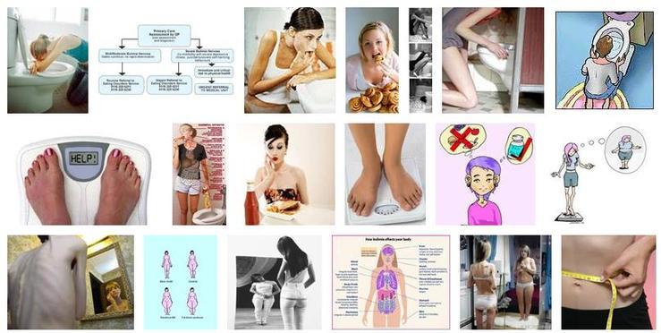 Bulimia Nervosa | Mind Map