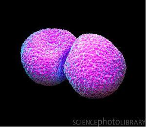 Streptococcus Pneumoniae | Mind Map